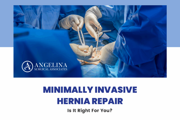 Minimally Invasive Hernia Repair: Is It Right For You? | Angelina ...
