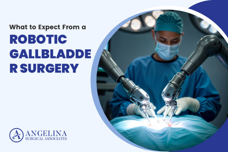 What to Expect From a Robotic Gallbladder Surgery | Angelina Surgical ...